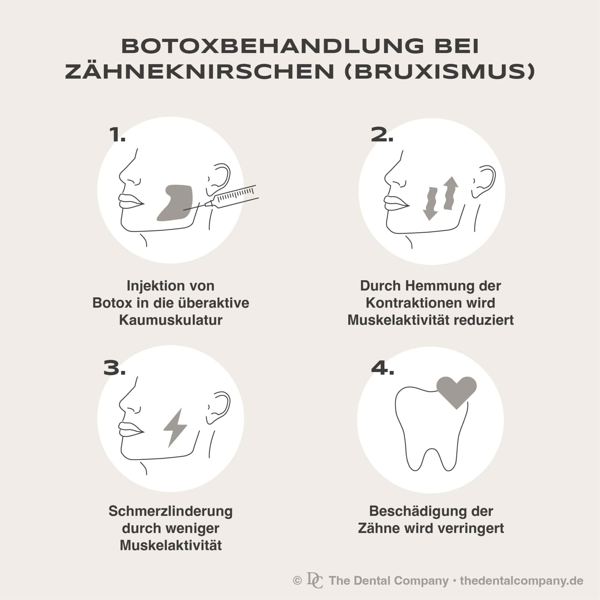 Botox gegen Zähneknirschen (Bruxismus) inkl. Erfahrungen